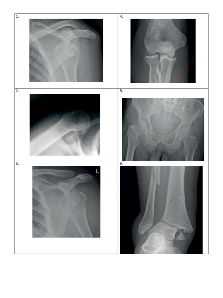 Radiografias | PDF | Hueso | Inflamación
