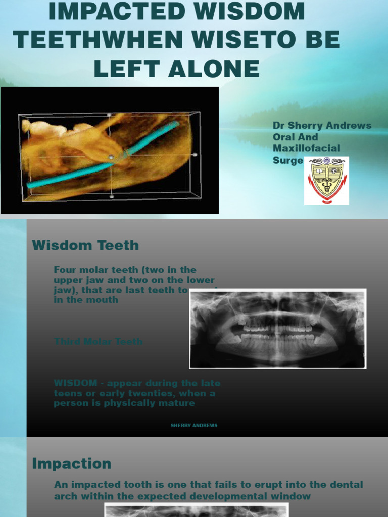 Impacted Wisdom Teeth Sherry | PDF | Human Tooth | Mouth