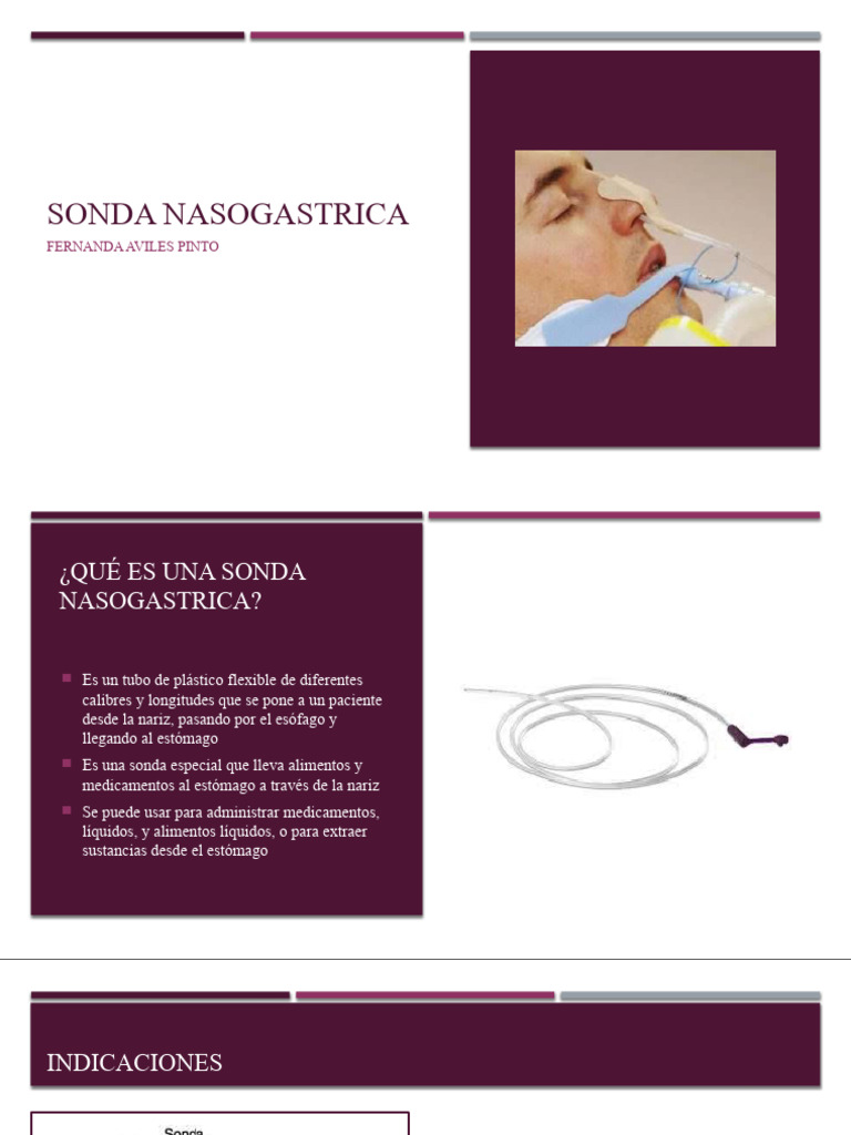 Sonda nasogastrica | PDF