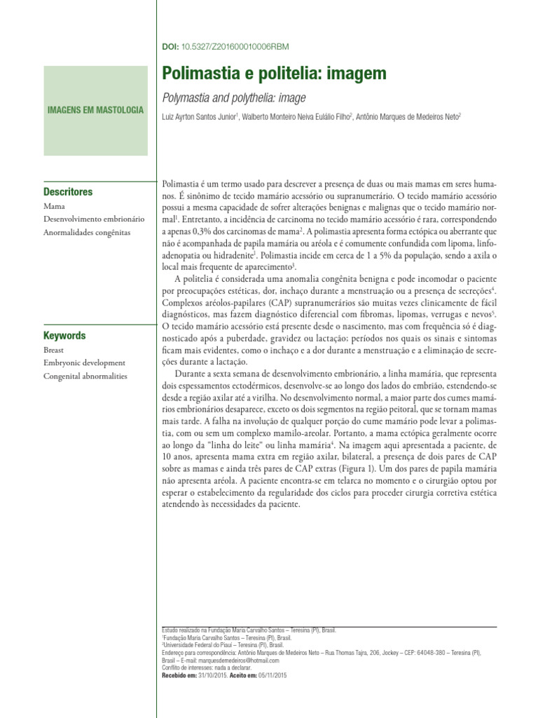 Politelia e Polimastia em Imagens Clínicas | PDF | Seio | Ginecologia