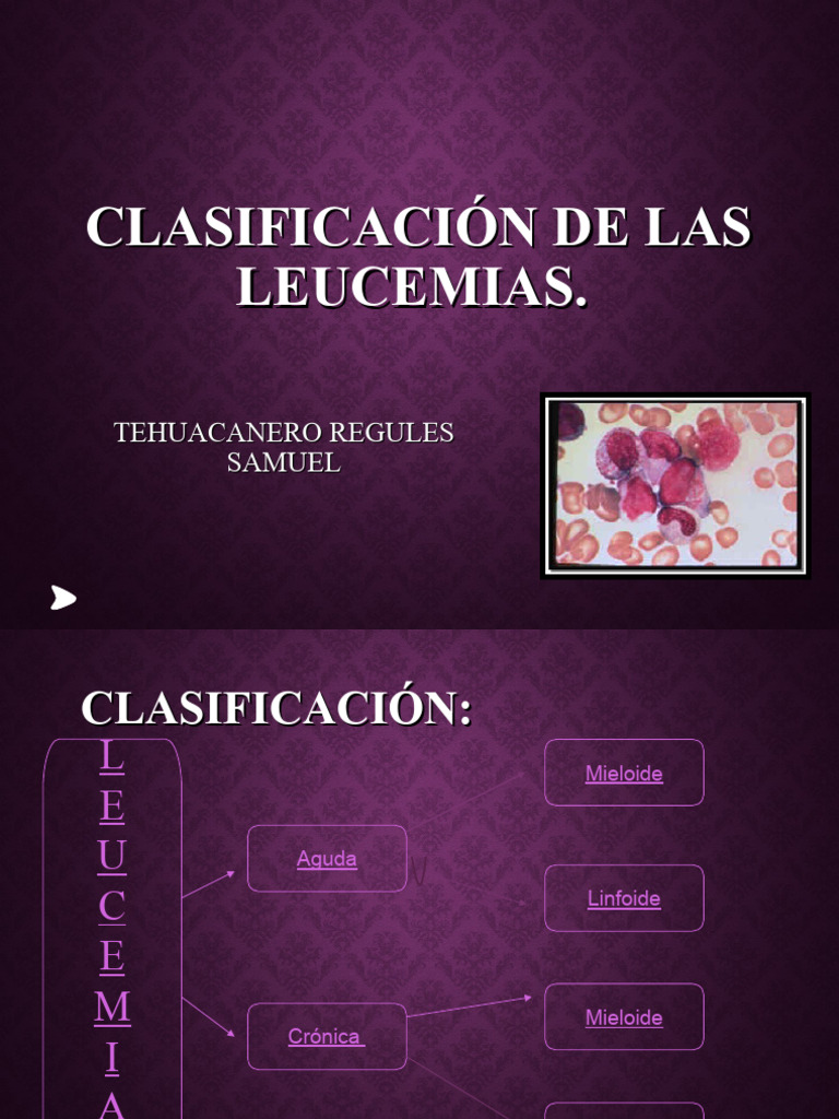 CLASIFICACION-DE-LEUCEMIAS-FAB | PDF | Leucemia | Medicina CLINICA