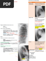 Ejemplo RX Torax Normal | PDF