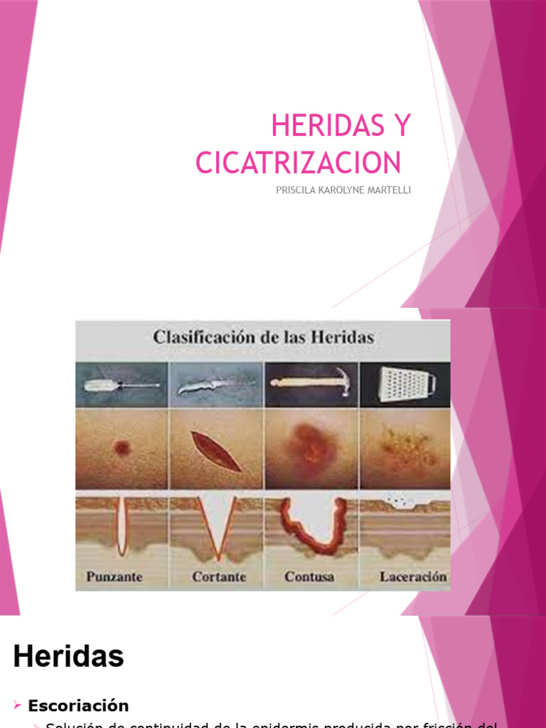 Tipos de Heridas y Cicatrización | PDF | Herida | Cicatrización de la ...