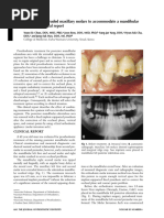 Management of Supraerupted Teeth | PDF | Tooth | Dentistry