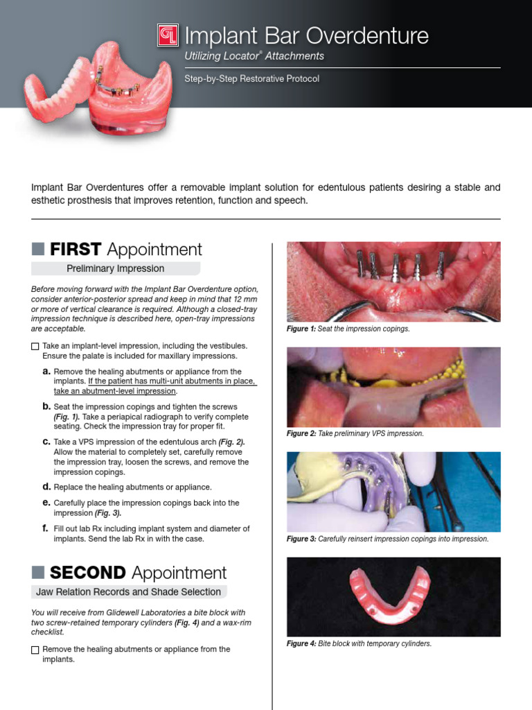 Implant Bar Overdenture | PDF | Dental Implant | Dentures