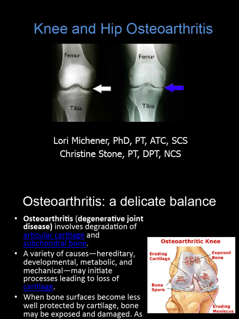 Hip and Knee OA | PDF | Osteoarthritis | Physical Therapy