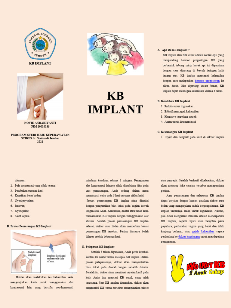 Leaflet Novie KB Implant | PDF