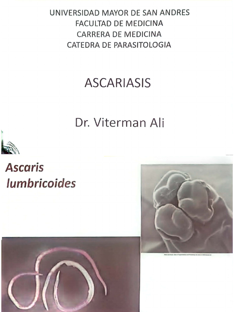 Ascariasis - Parasitología | PDF