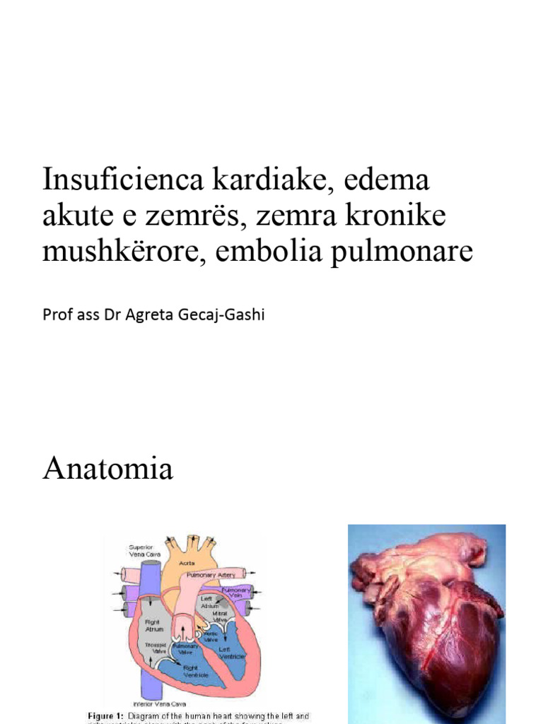 Insuficienca Kardiake, Edema Akute e Zemrës, Zemra Kronike Mushkërore ...