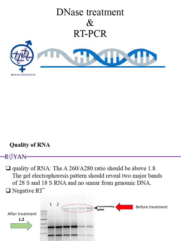 CDNA Synthesis | Download Free PDF | Reverse Transcription Polymerase Chain Reaction ...