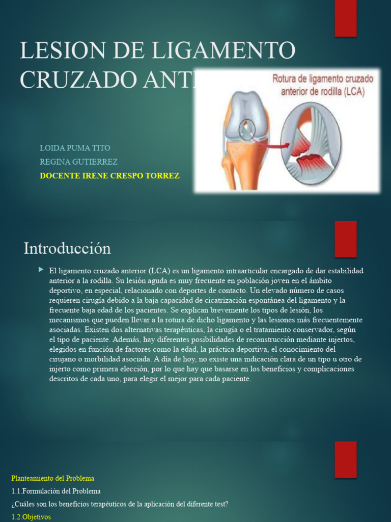 Lesión y evaluación del LCA en rodilla | PDF | Rodilla | Medicina CLINICA