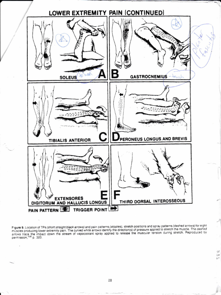 Lower Extremity Pain 2 | PDF | Soft Tissue | Limbs (Anatomy)