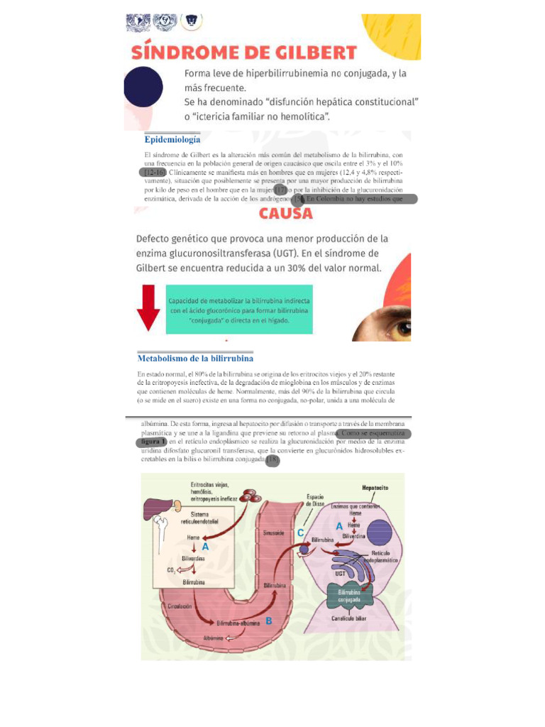 Sindrome de Gilbert | PDF