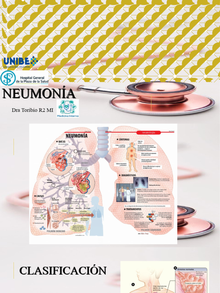 neumonia | PDF | Neumonía | Especialidades Medicas