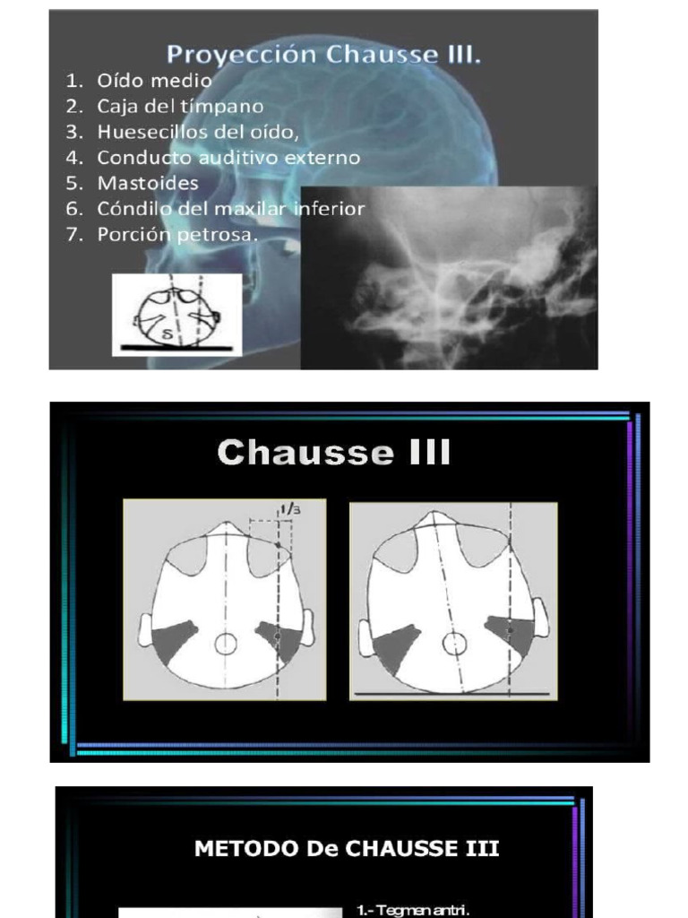 Chausse III | PDF