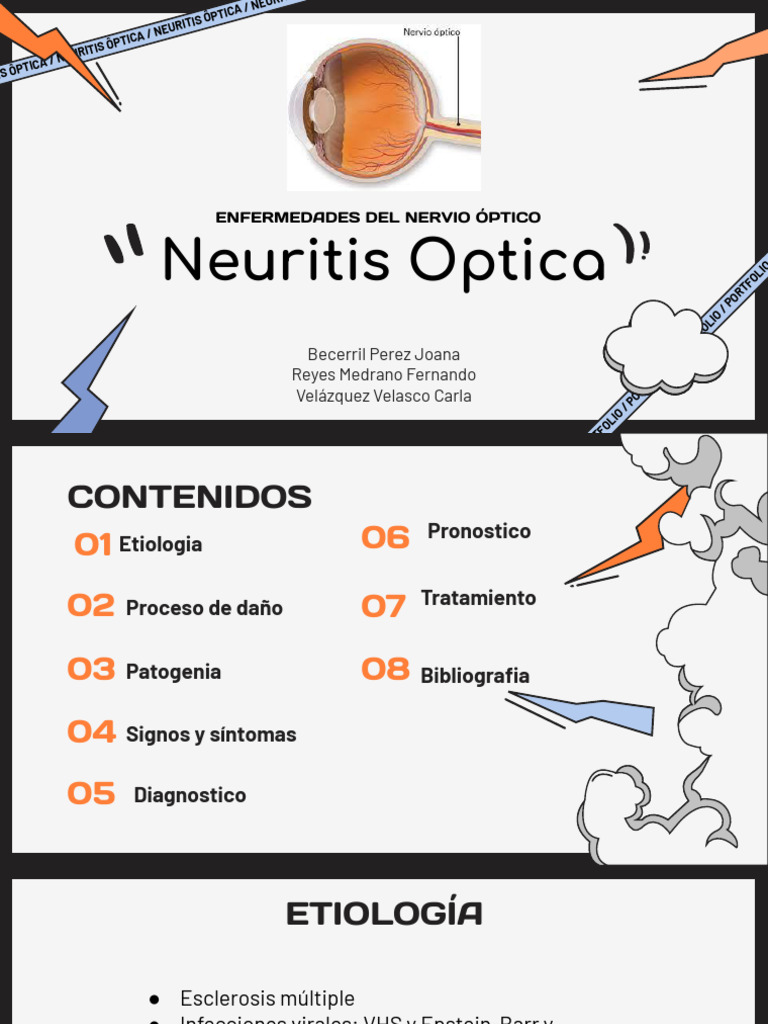 Neuritis Óptica | Descargar gratis PDF | Esclerosis múltiple | Causas ...
