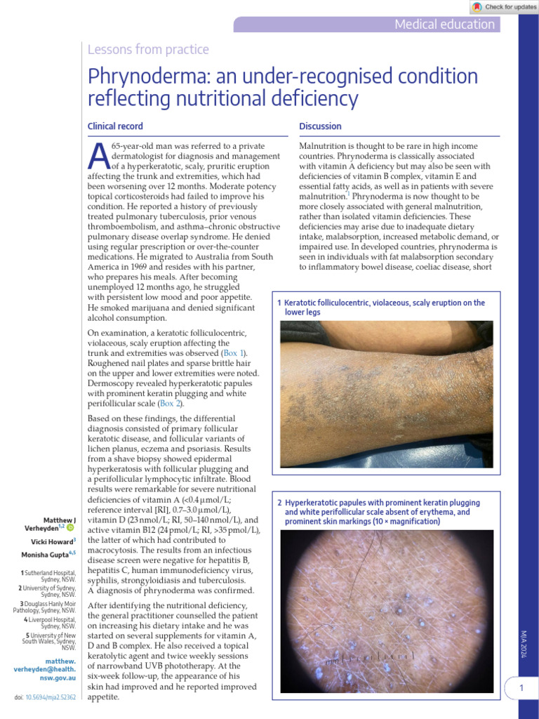 Phrynoderma: Nutritional Insights | PDF | Malnutrition | Vitamin