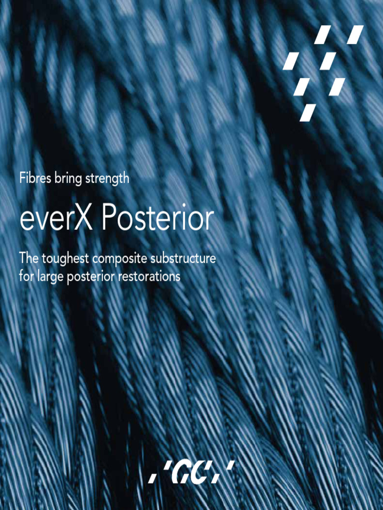Brochure Everx Posterior | PDF | Dental Composite | Composite Material