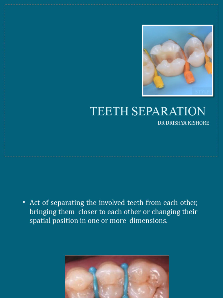 Teeth Separation | PDF | Human Tooth | Orthodontics