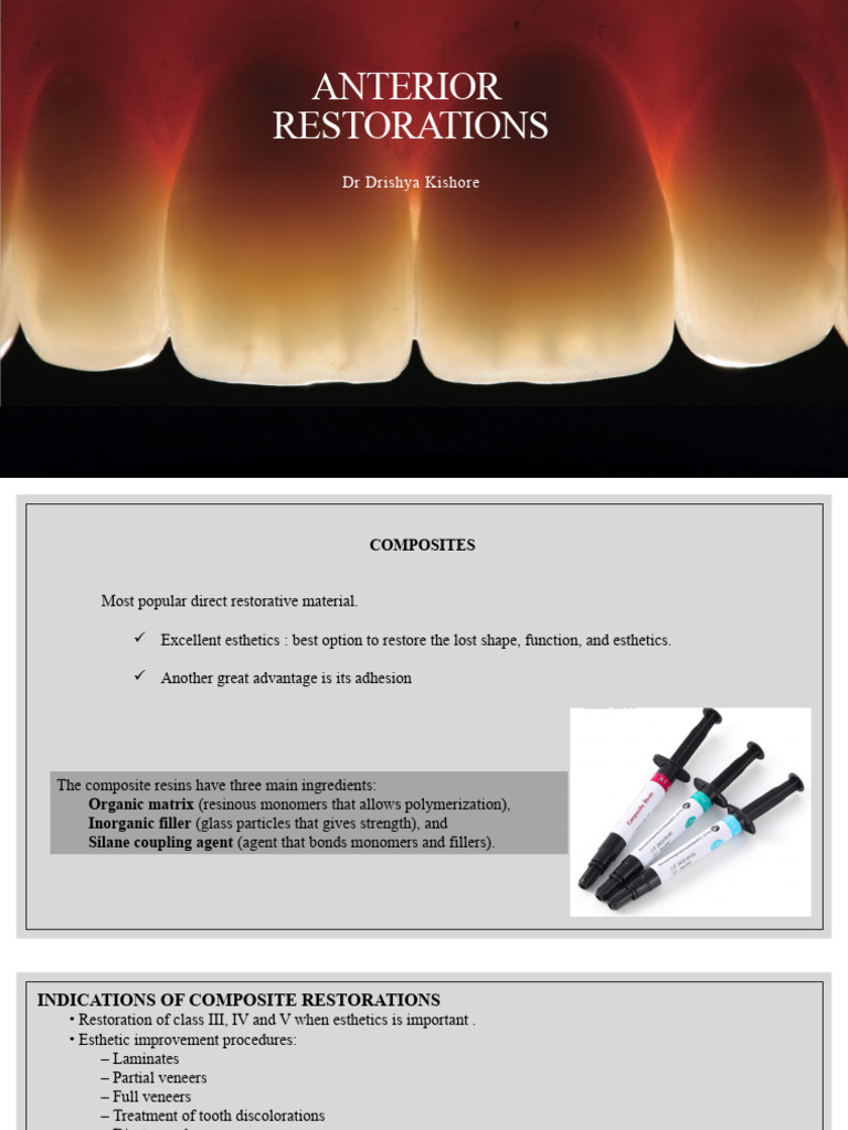 Anterior Restorations | PDF | Tooth Enamel | Dental Composite