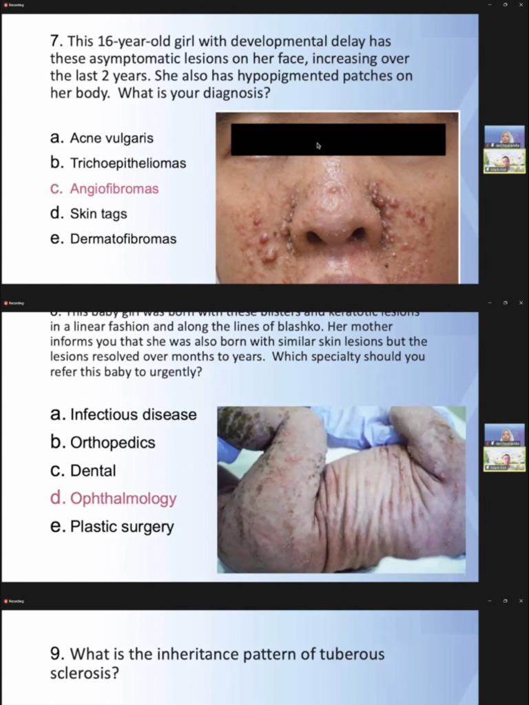Modules 3-Pediatric Dermatology Introductory Course | PDF
