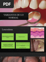 Revisión del Leucoedema Oral | PDF | Epitelio | Biología Celular)