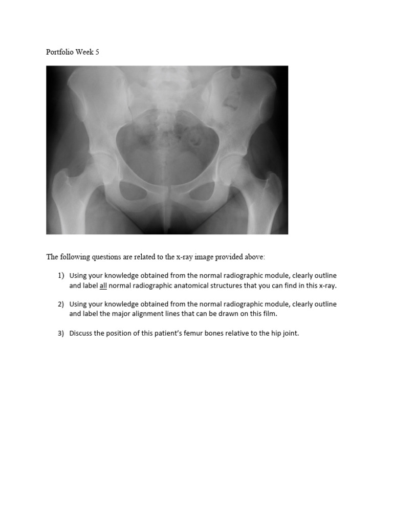 CHIR6410 Portfolio Entry 2 | PDF | Radiography | X Ray