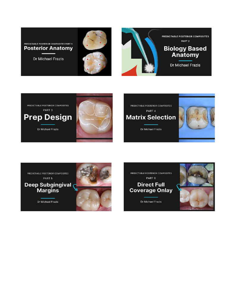 Ripe Predicable Posterior Composites Principles, Concepts, Techniques | PDF