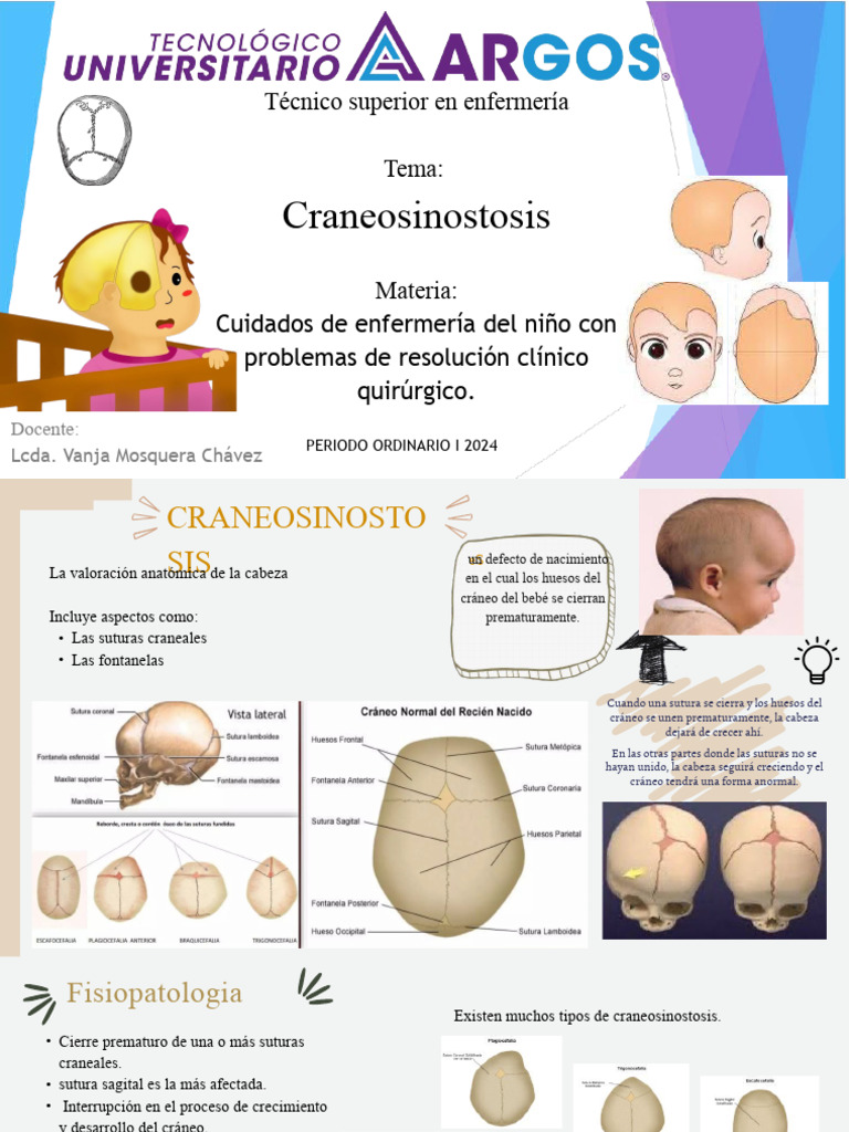 Craneosinostosis. PPTX LOOR JESSICA | PDF | Cráneo | Herida