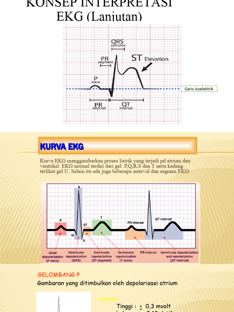 Interpretasi Lanjutan EKG: Gelombang dan Segmen | PDF