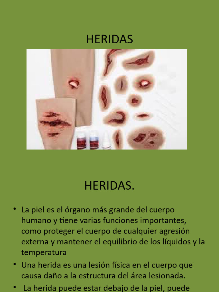 HERIDAS | PDF | Herida | Quemar