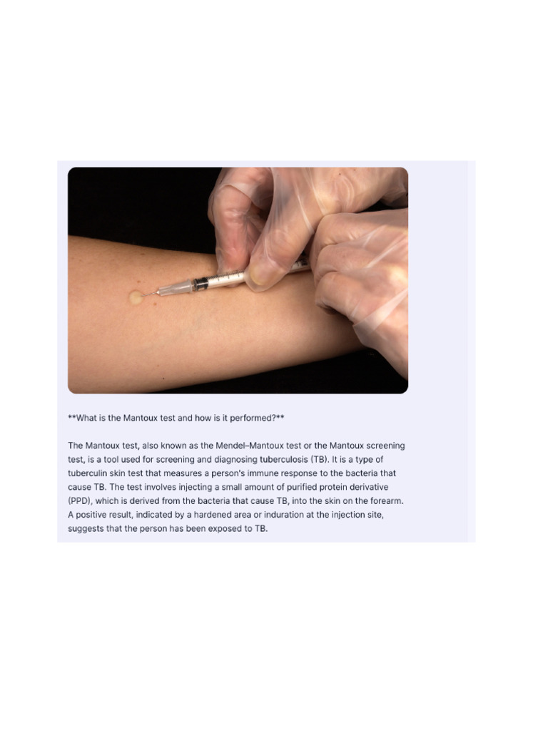 Mantoux | PDF