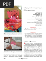 AngioDynamics Smart Port Instructions | PDF | Intravenous Therapy ...