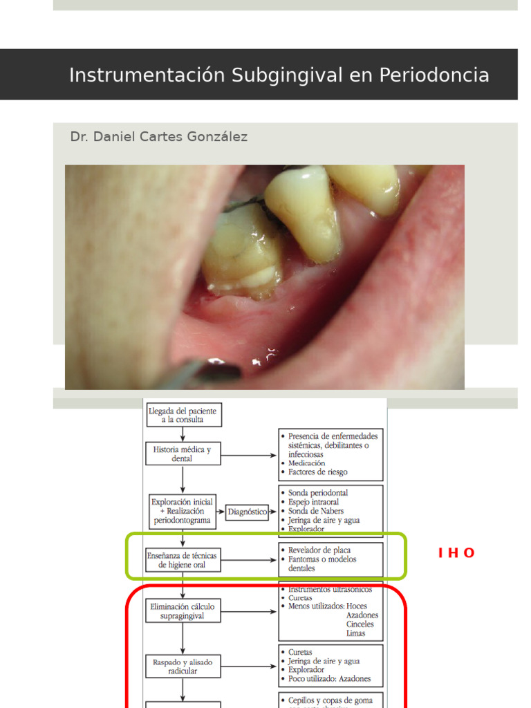 Instrumentacion Subgingival | PDF | Especialidades Medicas