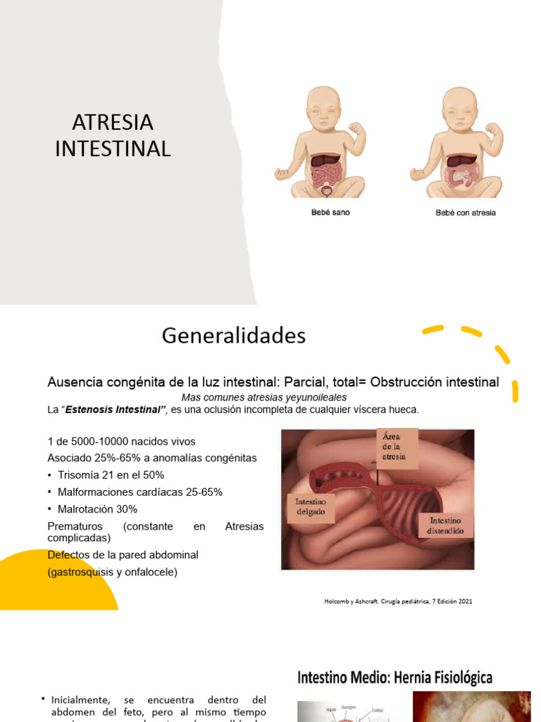 atresia-intestinal-1 | Descargar gratis PDF | Abdomen | Intestino grueso