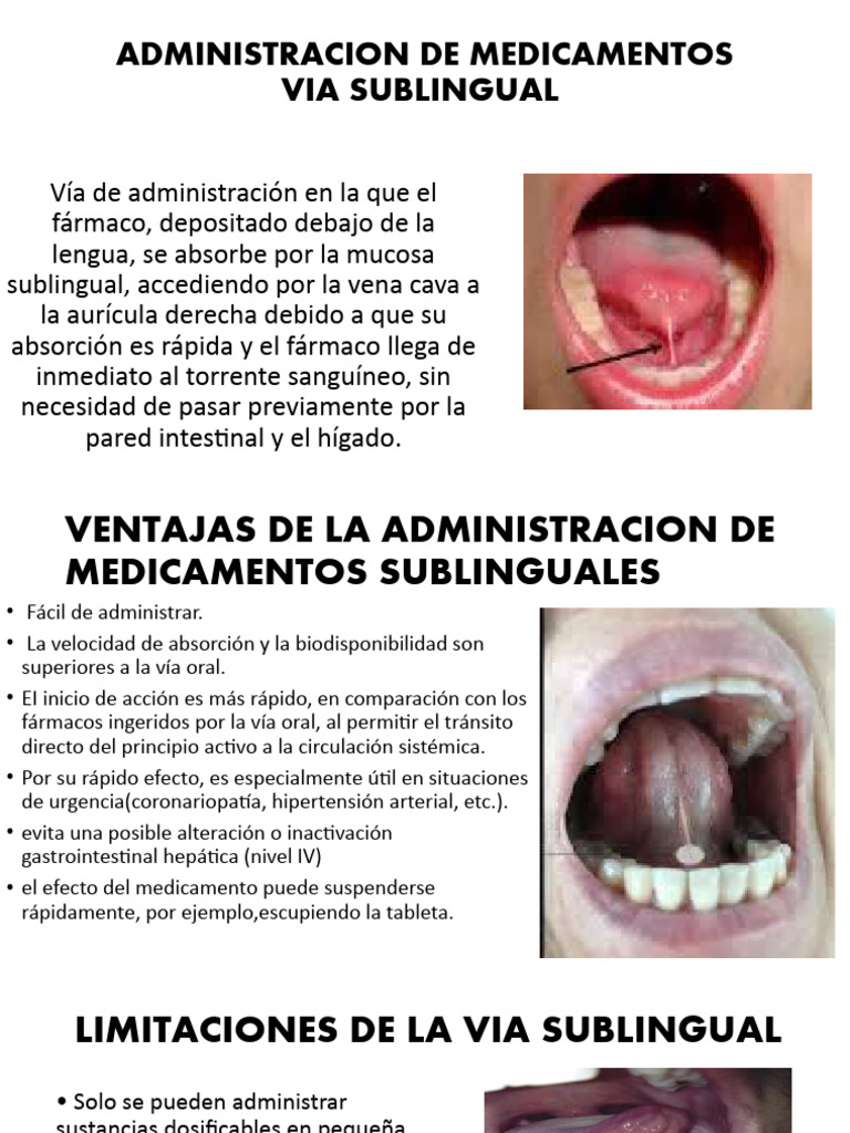 Jhoel Administracion de Medicamentos Via Sublingual | PDF ...