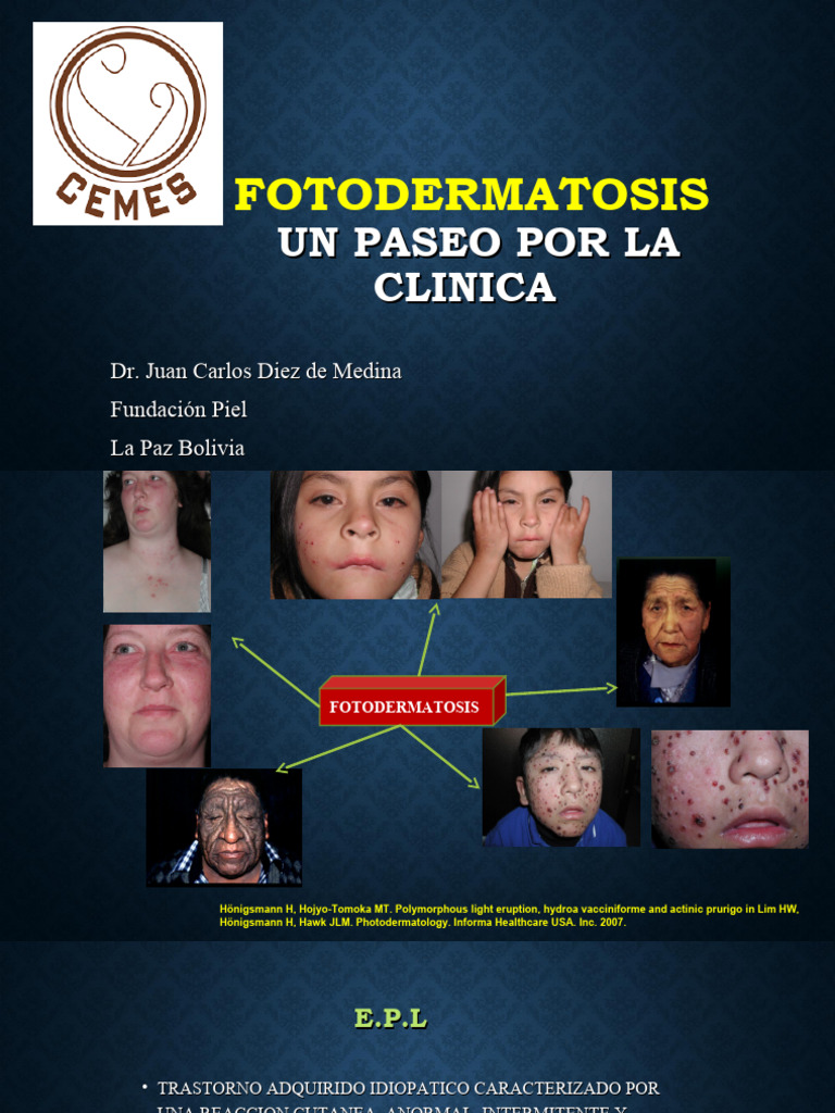 Fotodermatosis Un Paseo Por La Clinica Rosario | PDF | Sistema inmune ...