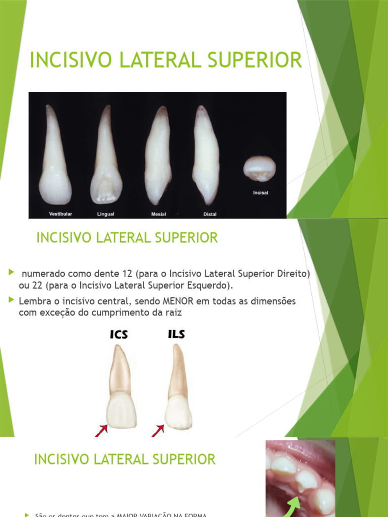 Anatomia do Incisivo Lateral Superior | PDF | Dente humano | Dente