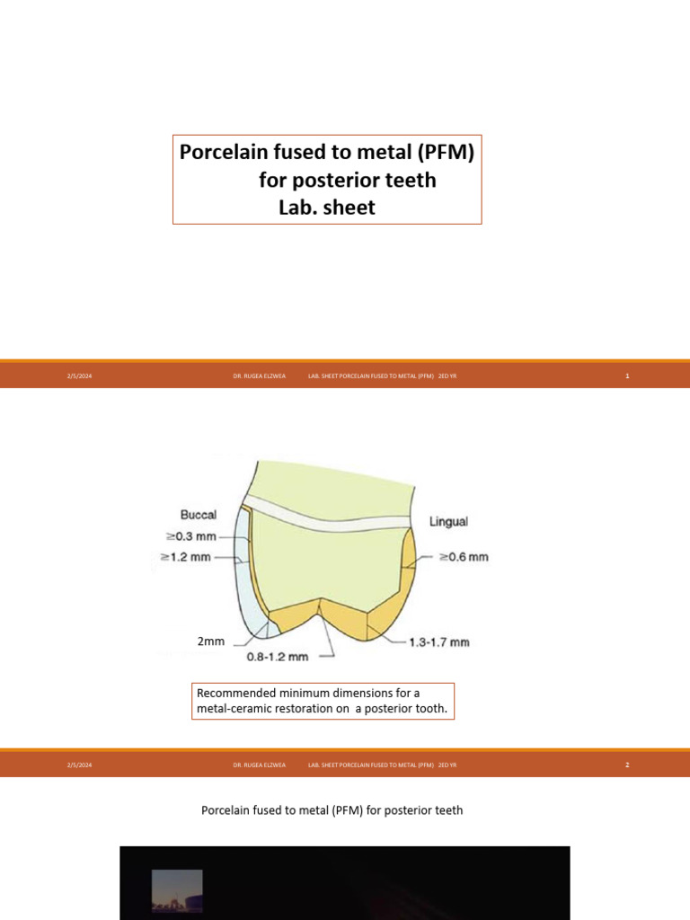 Lab Pos. Teeth Prep | PDF | Dentistry | Mouth