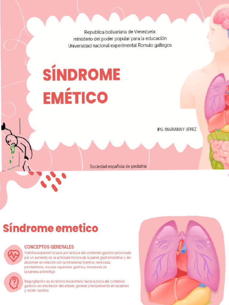 Sindrome Emetico Pediatria | PDF