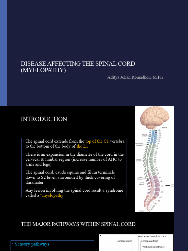 Disease Affecting The Spinal Cord (Myelopathy) : Aditya Johan Romadhon ...