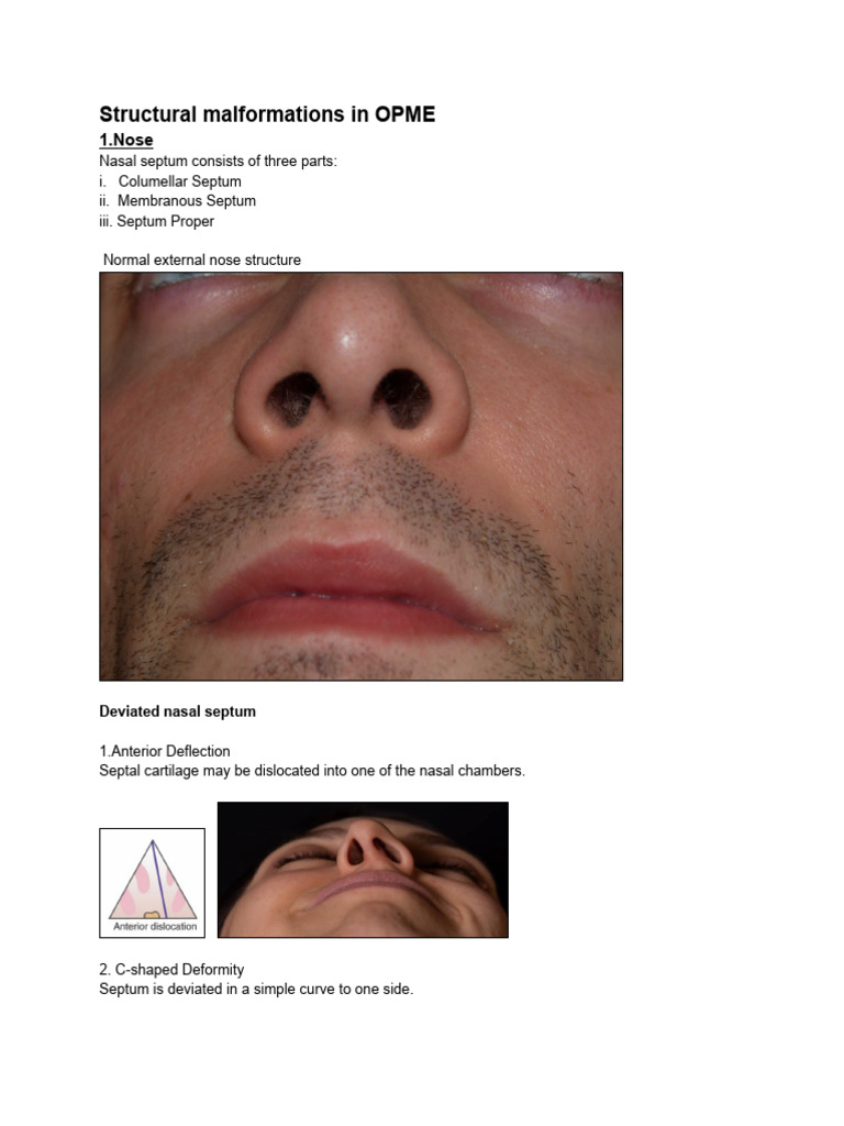 OPME Assignment | PDF | Human Nose | Lip