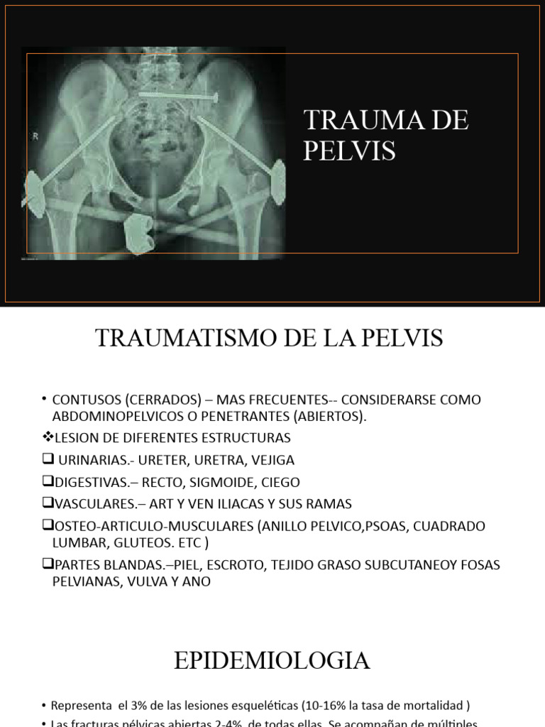 Trauma de Pelvis | PDF | Pelvis | Anatomía