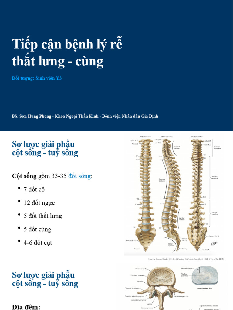 Lumbosacral Radiculopathy Approach | PDF