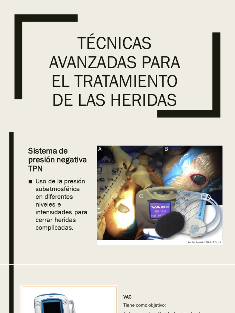 Tecnicas Avanzadas en El Tratamiento de Heridas | PDF | Herida | Oxígeno