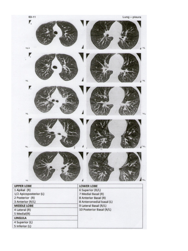 Segmentasi CT Scan Paru | PDF