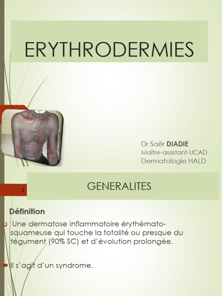 Érythrodermie : Causes et Diagnostic | PDF | Immunologie | Spécialités ...
