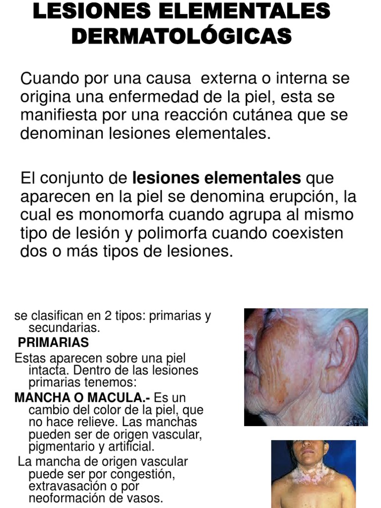 LESIONES ELEMENTALES DERMATOLÓGICAS | Piel | Medicina CLINICA