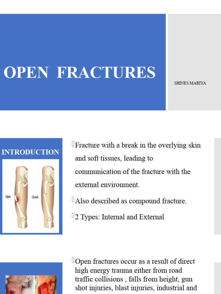 Open Fractures -Ortho_015358 | Download Free PDF | Amputation | Wound