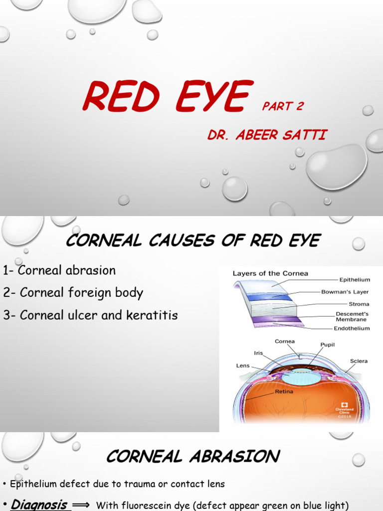 5-Red eye part (2) | PDF | Immunology | Clinical Medicine